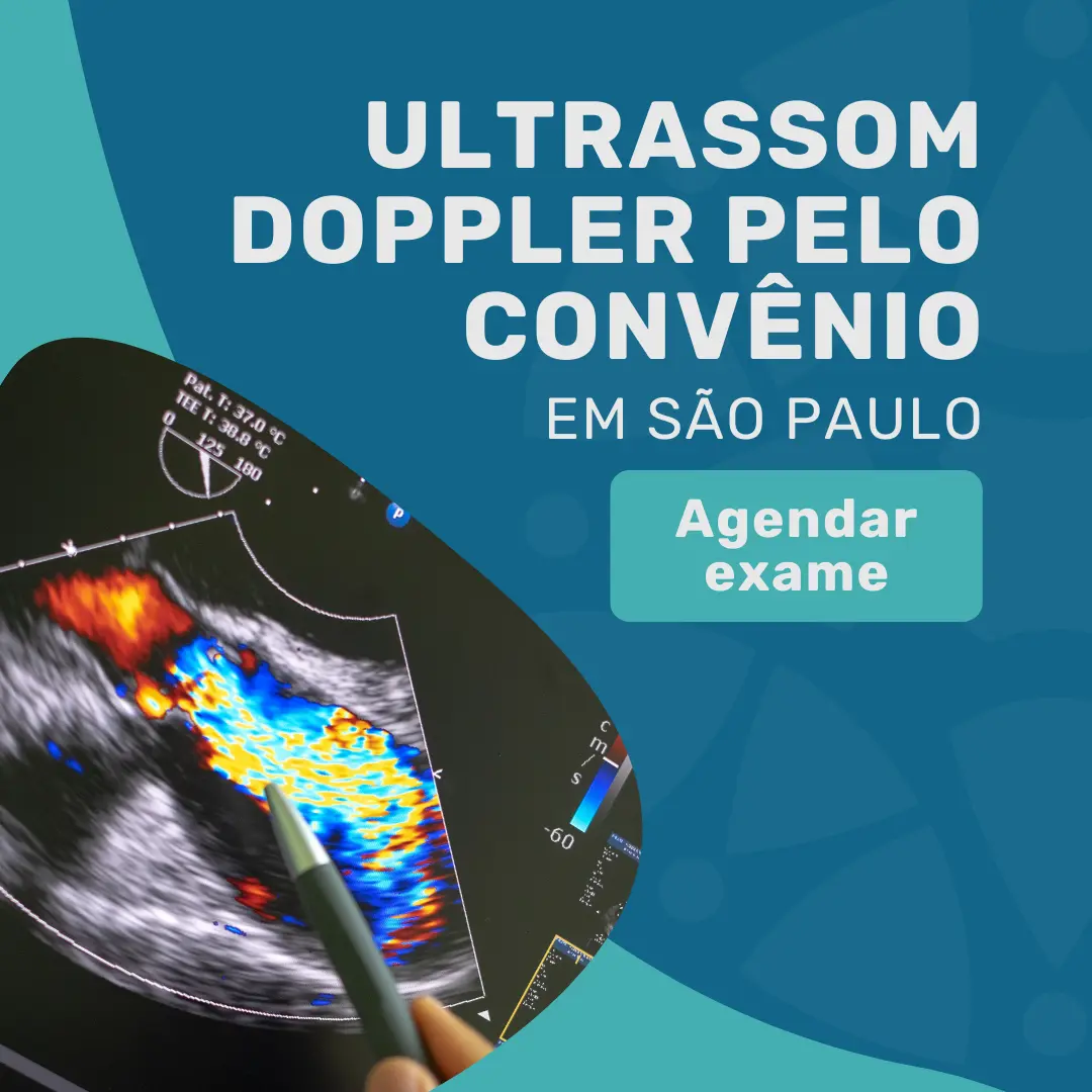 Ultrassom doppler pela Mediservice em SP - Dr. Rodrigo Barbosa